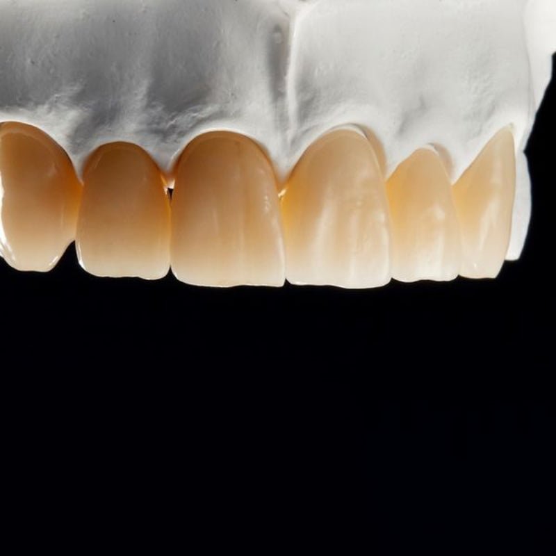Overview of Multi-Layer Dental Zirconia Products | CeraDirect Daily ...
