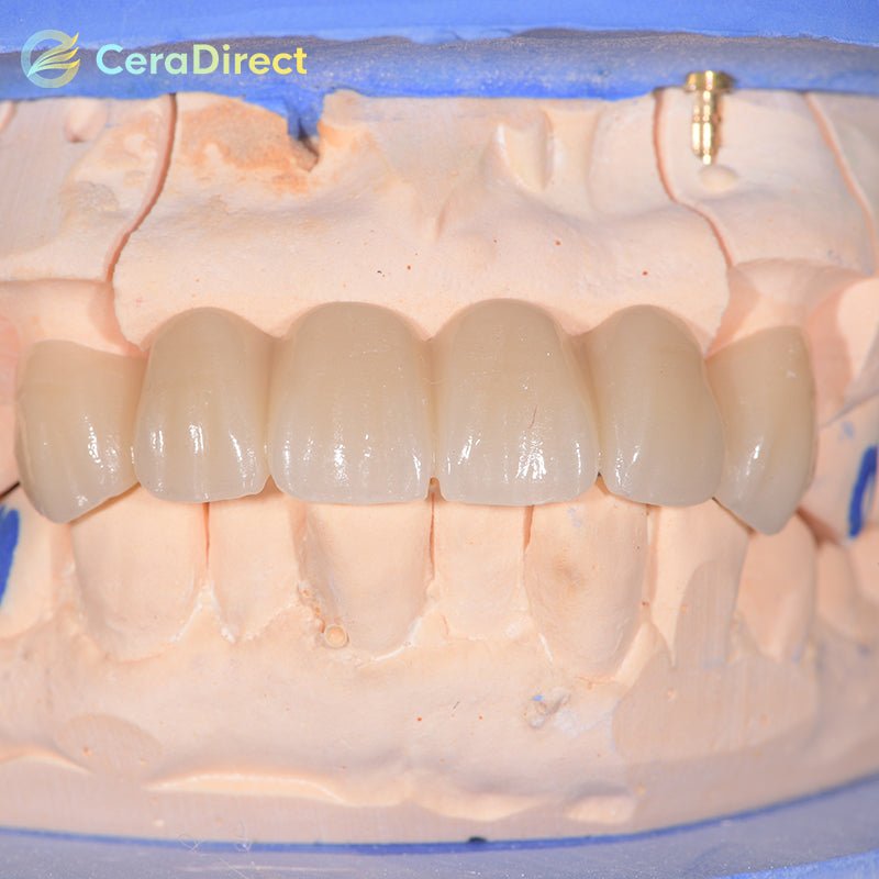 3D Pro—Multilayer Zirconia Disc Open System (98mm)C1-D4